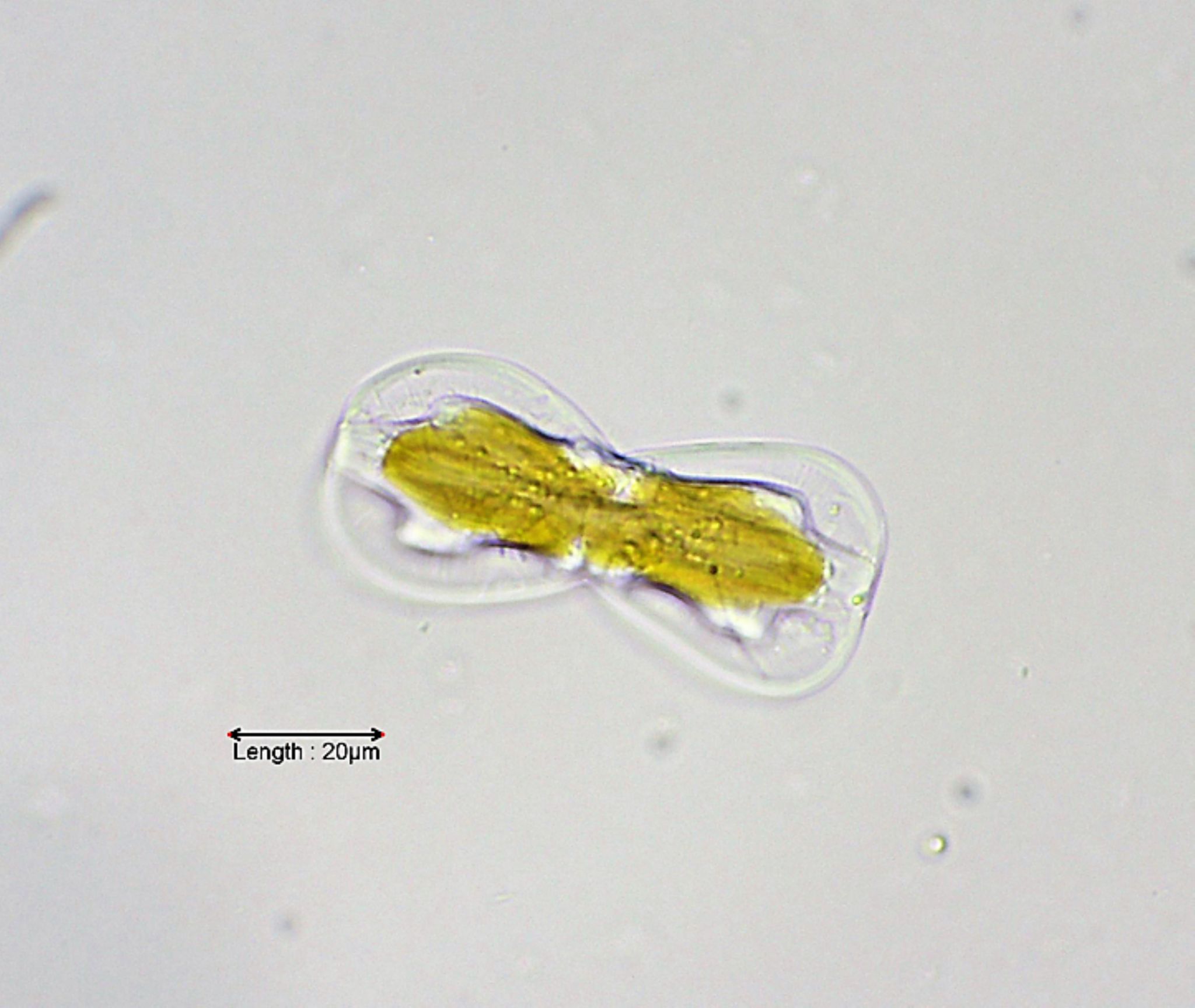 Diatomeae – A Planktonista's world