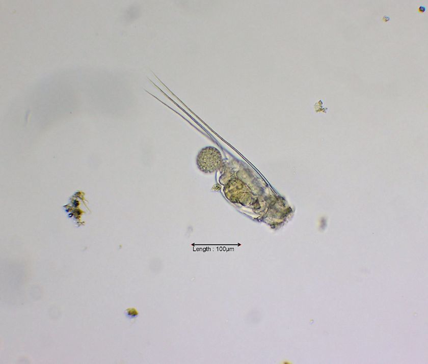 Rotifera – A Planktonista's world