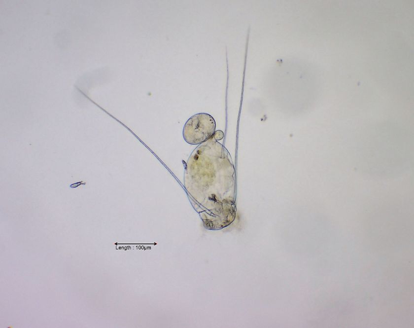 Rotifera – A Planktonista's world