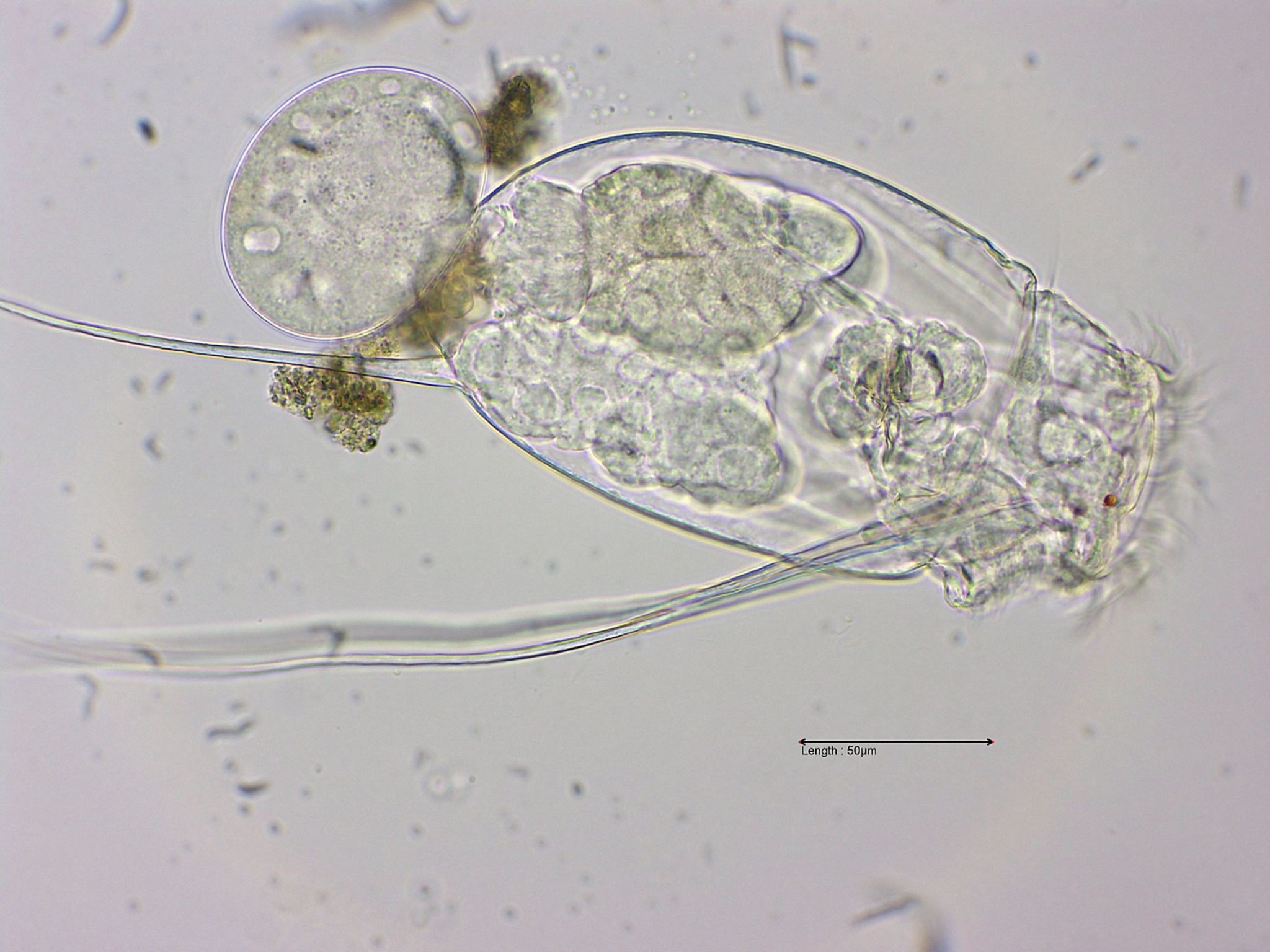 Rotifera – A Planktonista's world