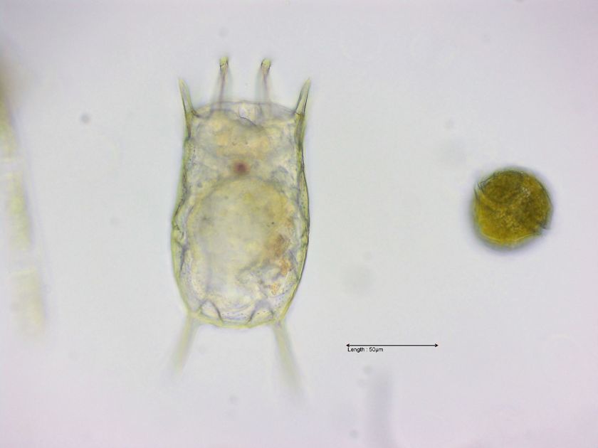 Rotifera – A Planktonista's world