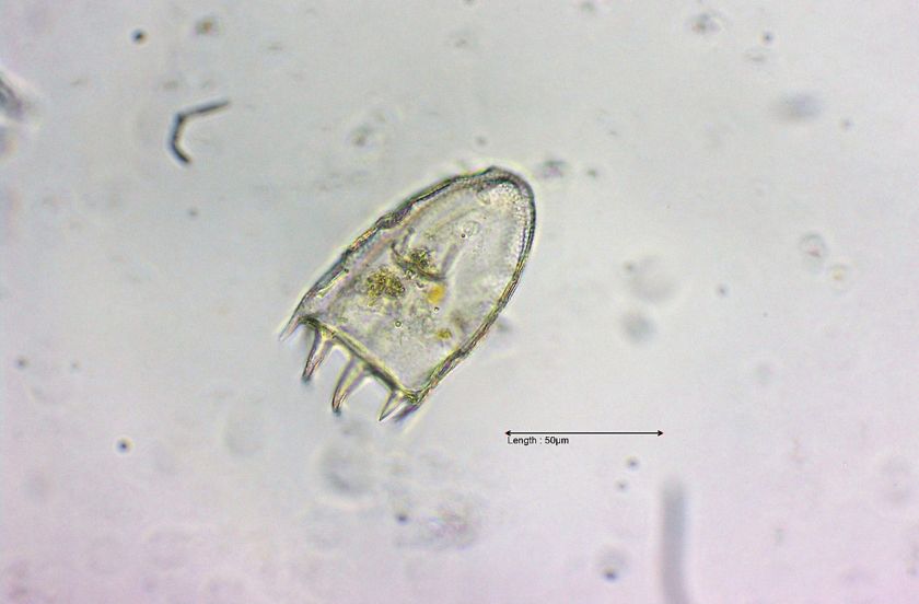 Rotifera – A Planktonista's world
