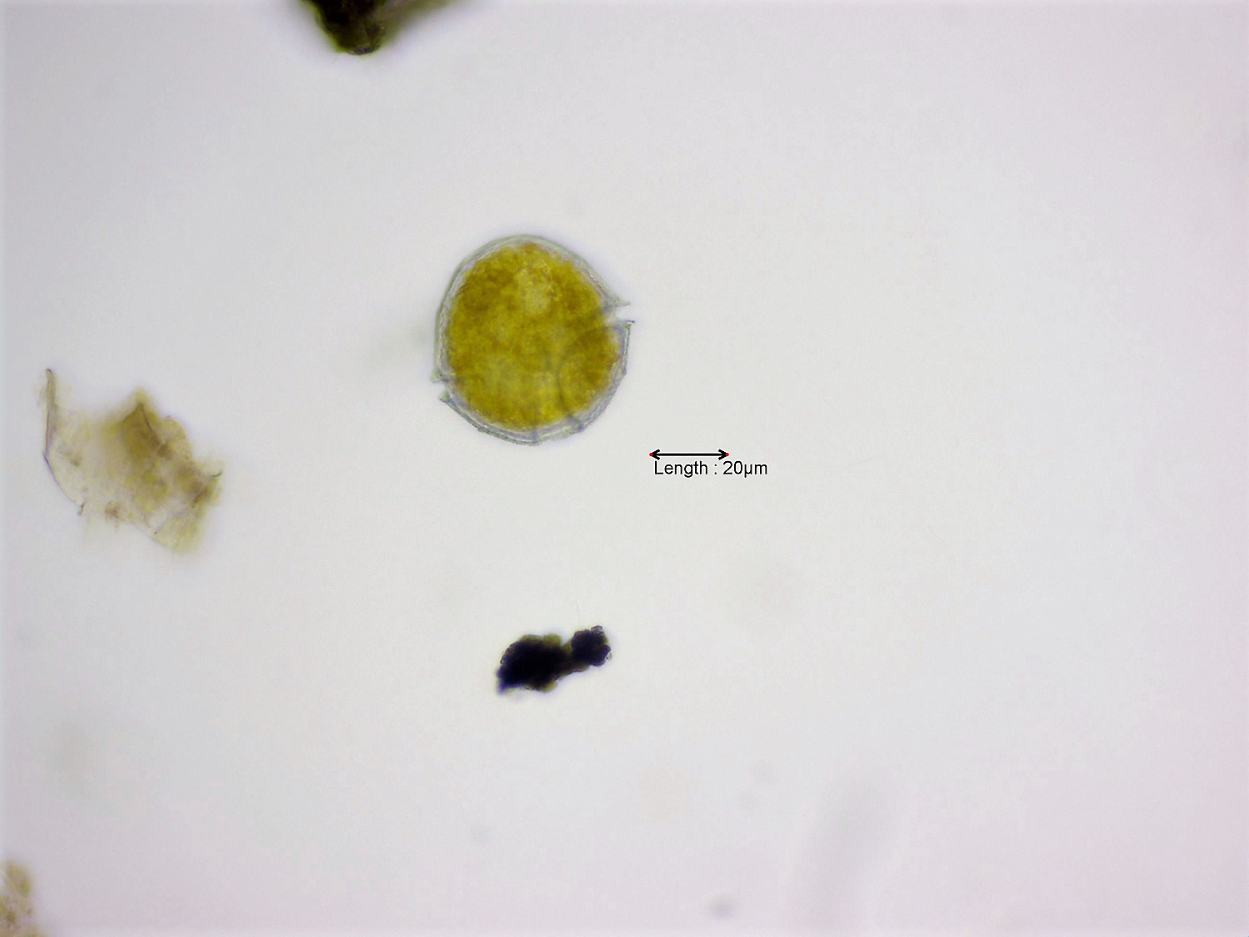 Dinophyta – A Planktonista's world