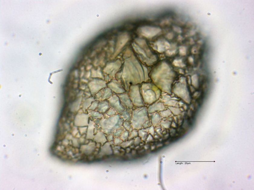 Testate amoebae – A Planktonista's world