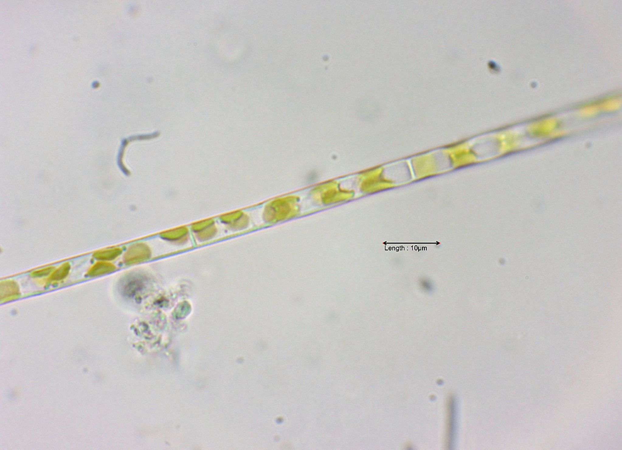 Xanthophyta – A Planktonista's world