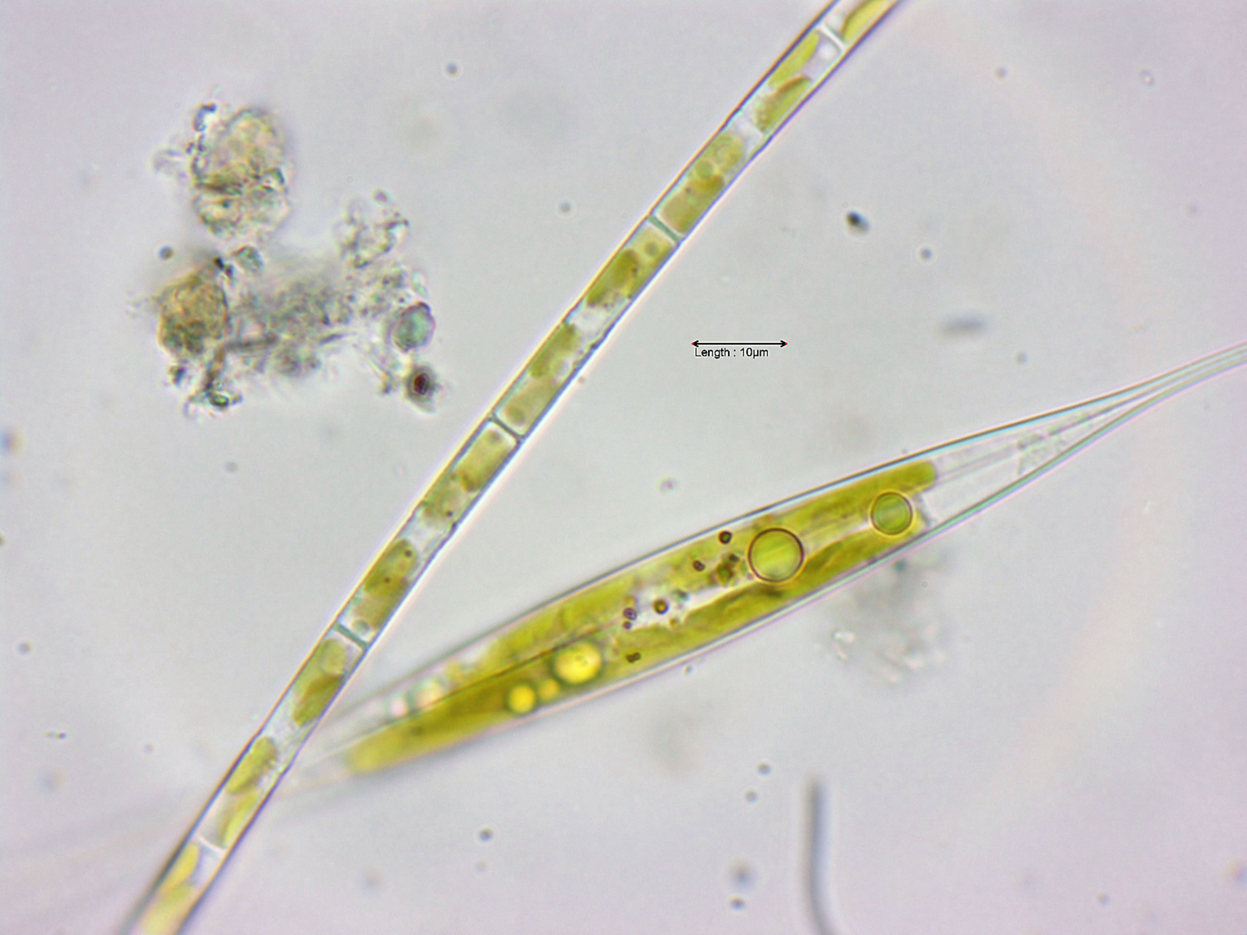 Xanthophyta – A Planktonista's world