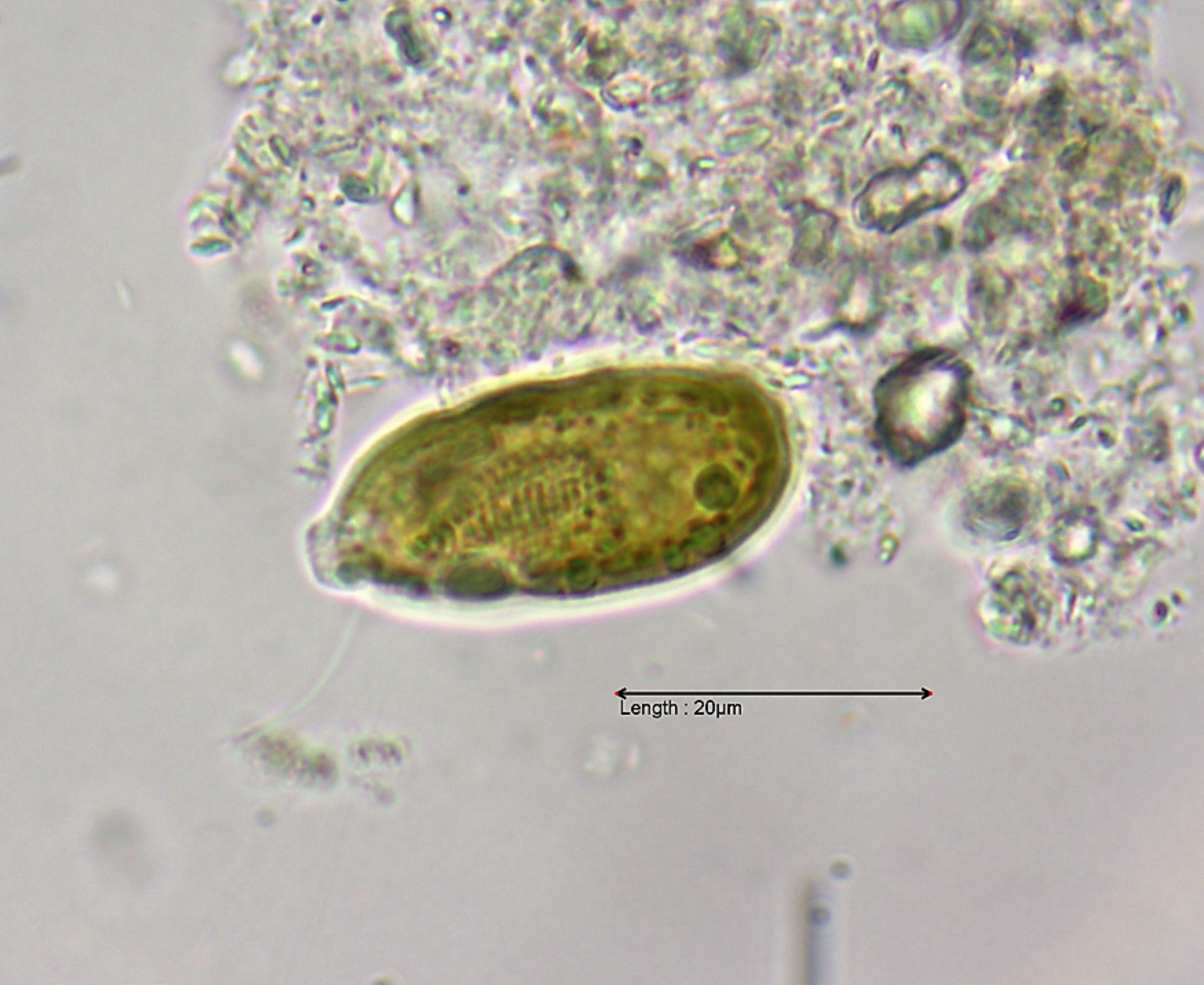 Cryptophyta – A Planktonista's world