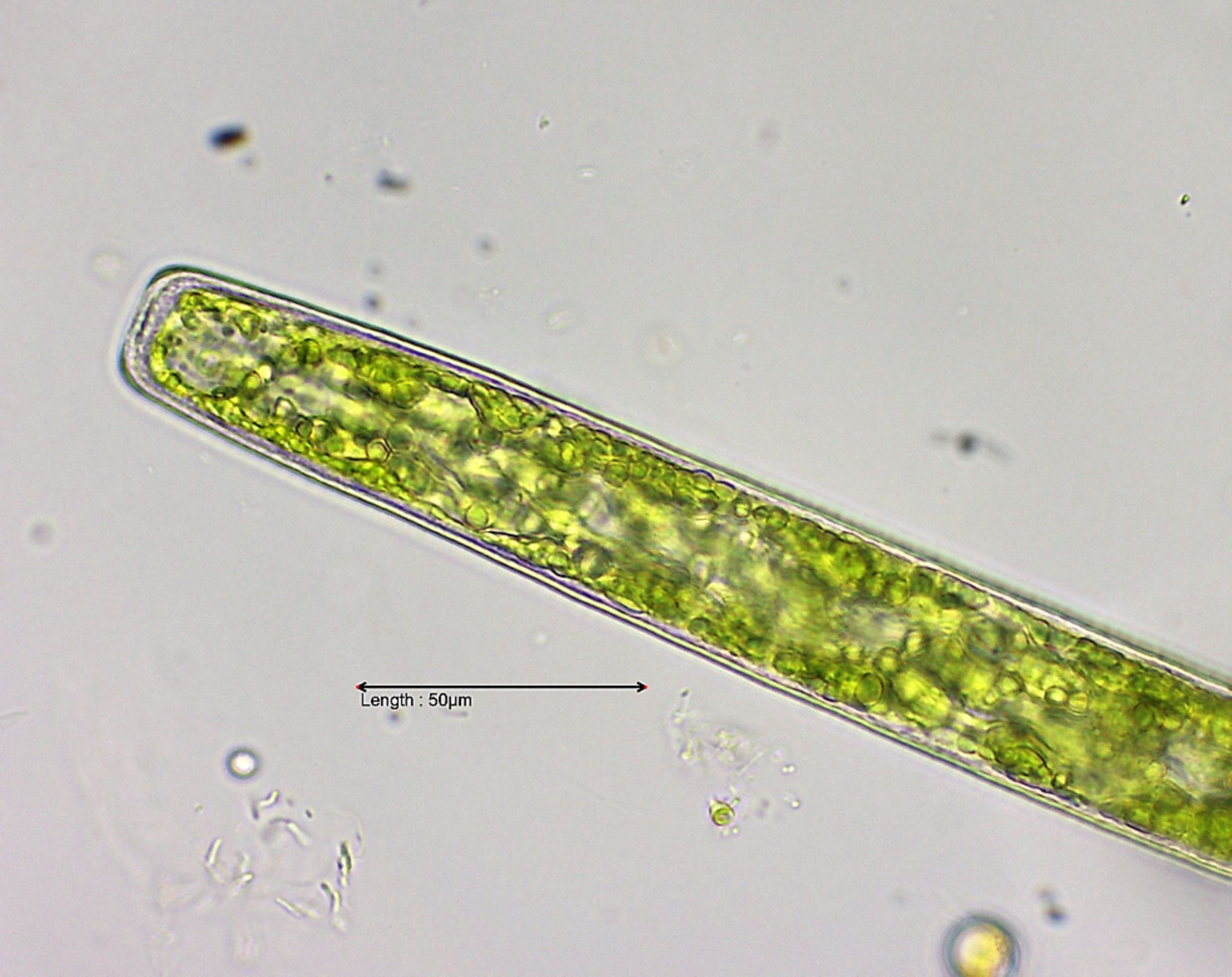 Desmids and Zygnematales – A Planktonista's world