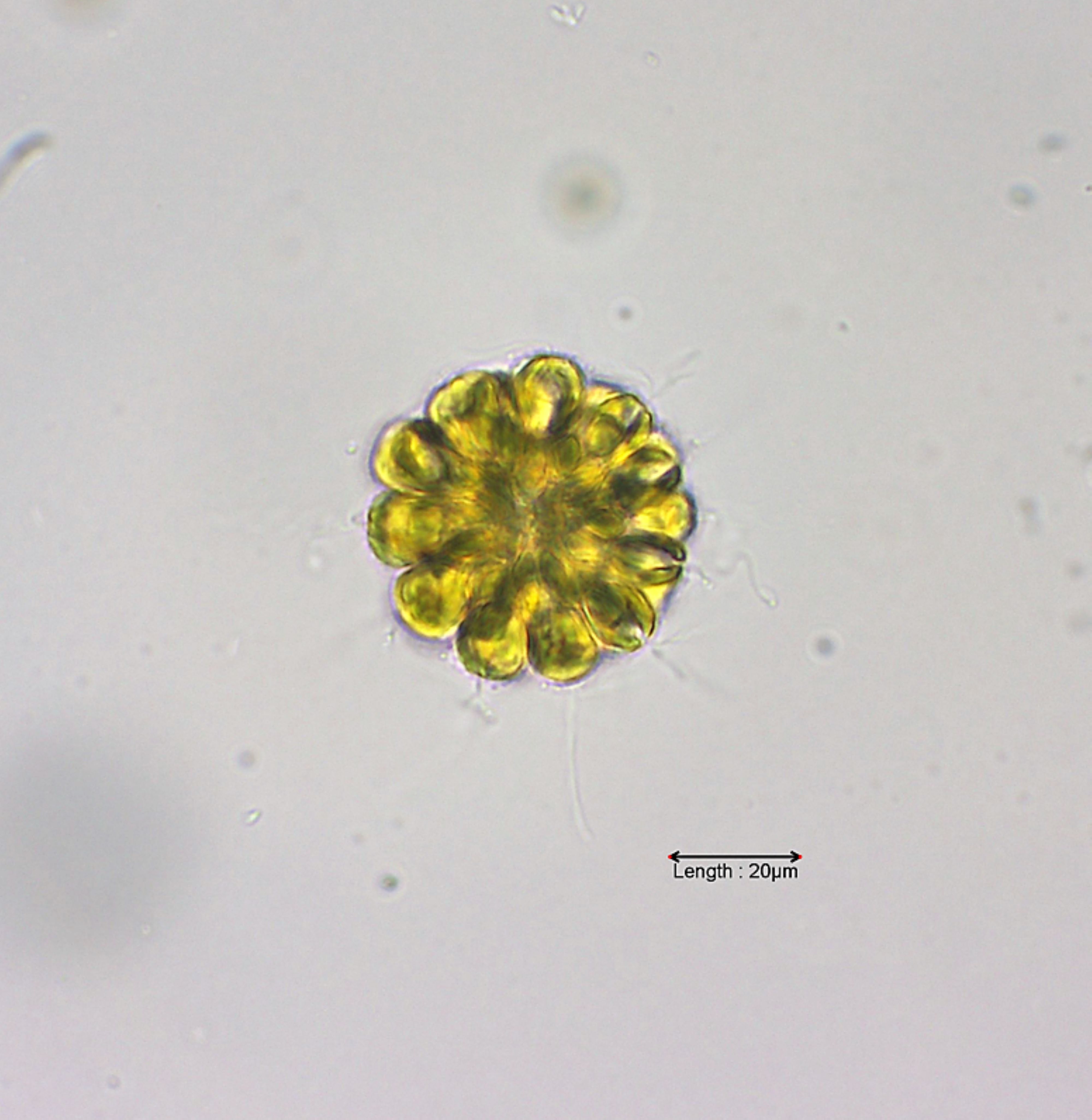 Chrysophyta – A Planktonista's world