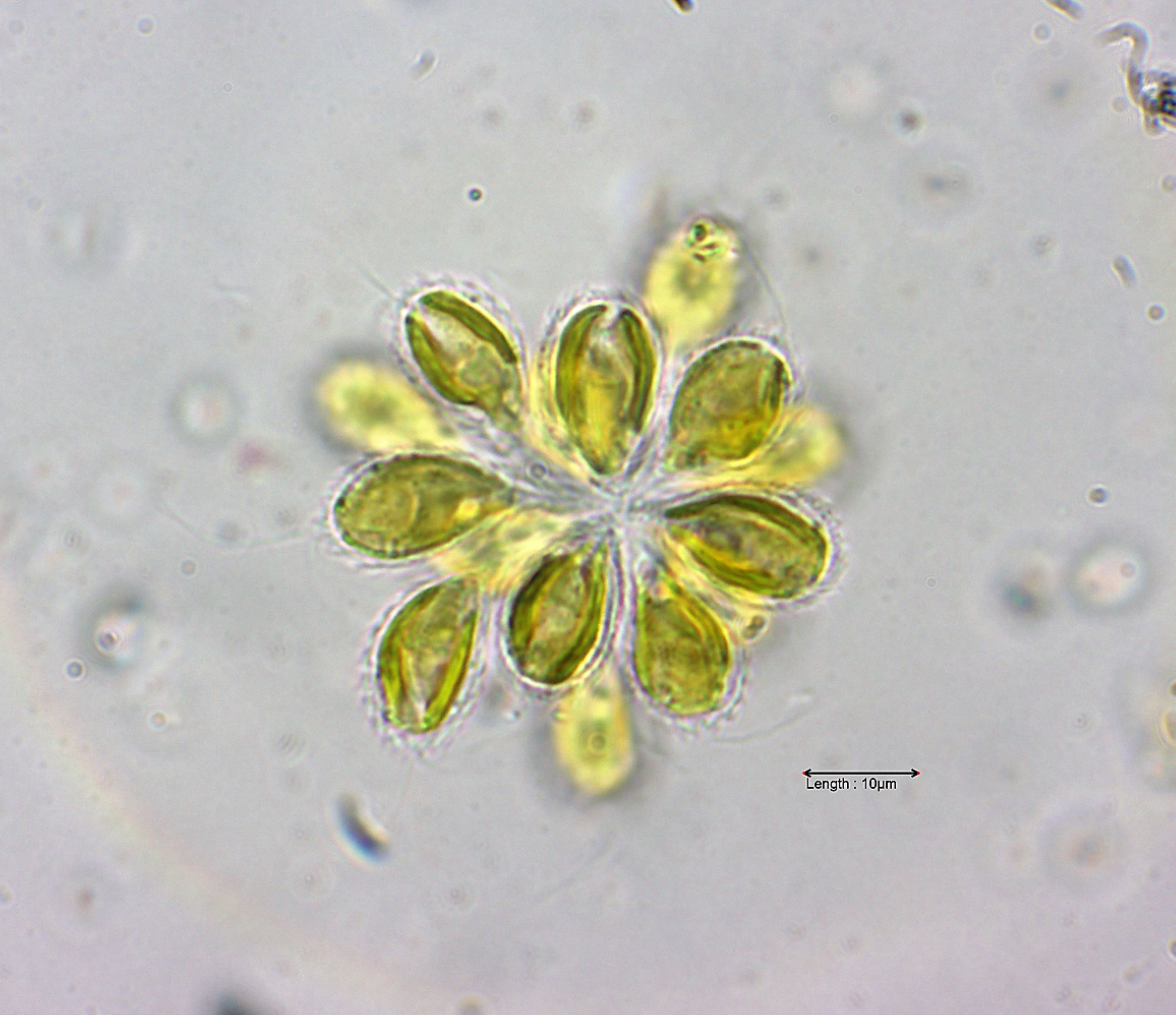 Chrysophyta – A Planktonista's world