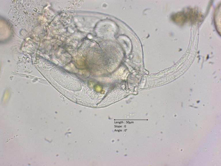 Rotifera – A Planktonista's world