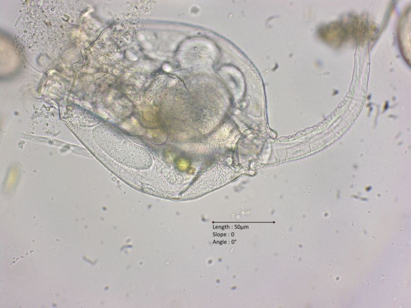 Rotifera – A Planktonista's world