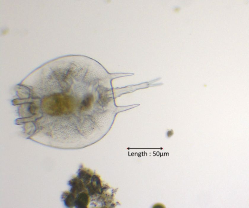 Rotifera – A Planktonista's world
