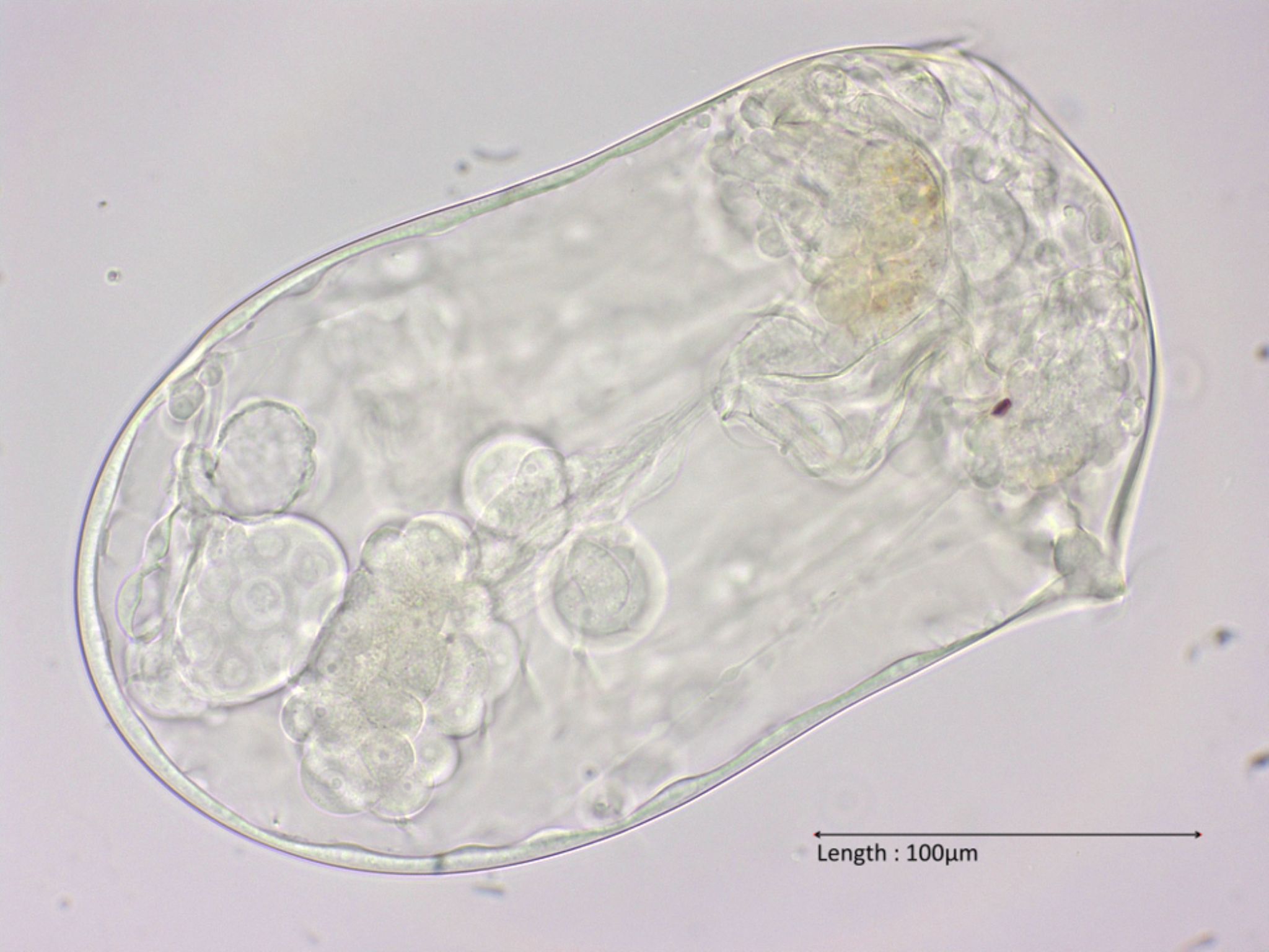 Rotifera – A Planktonista's world