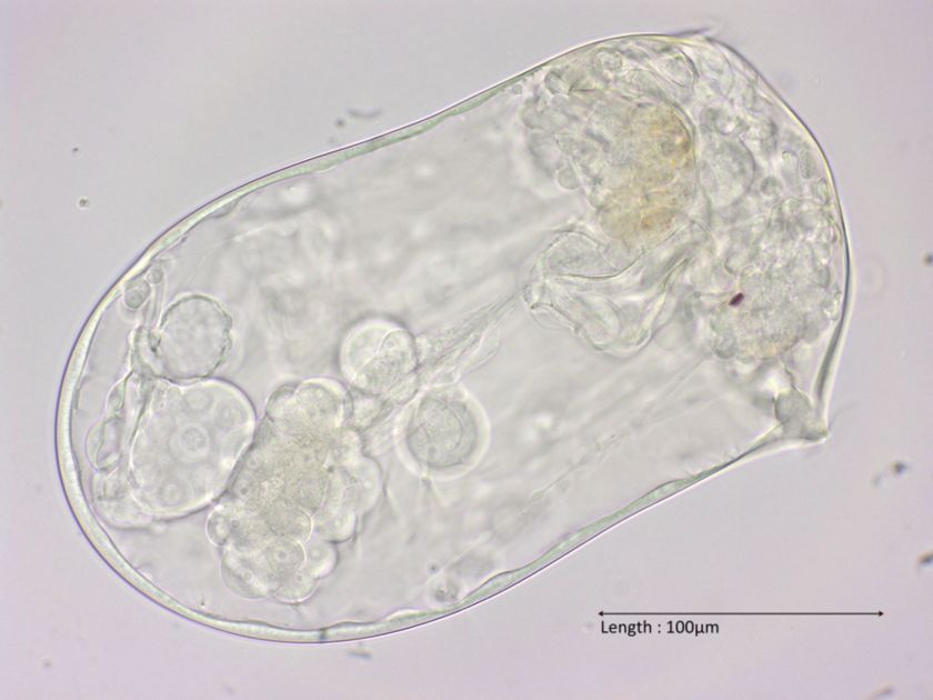 Rotifera – A Planktonista's world