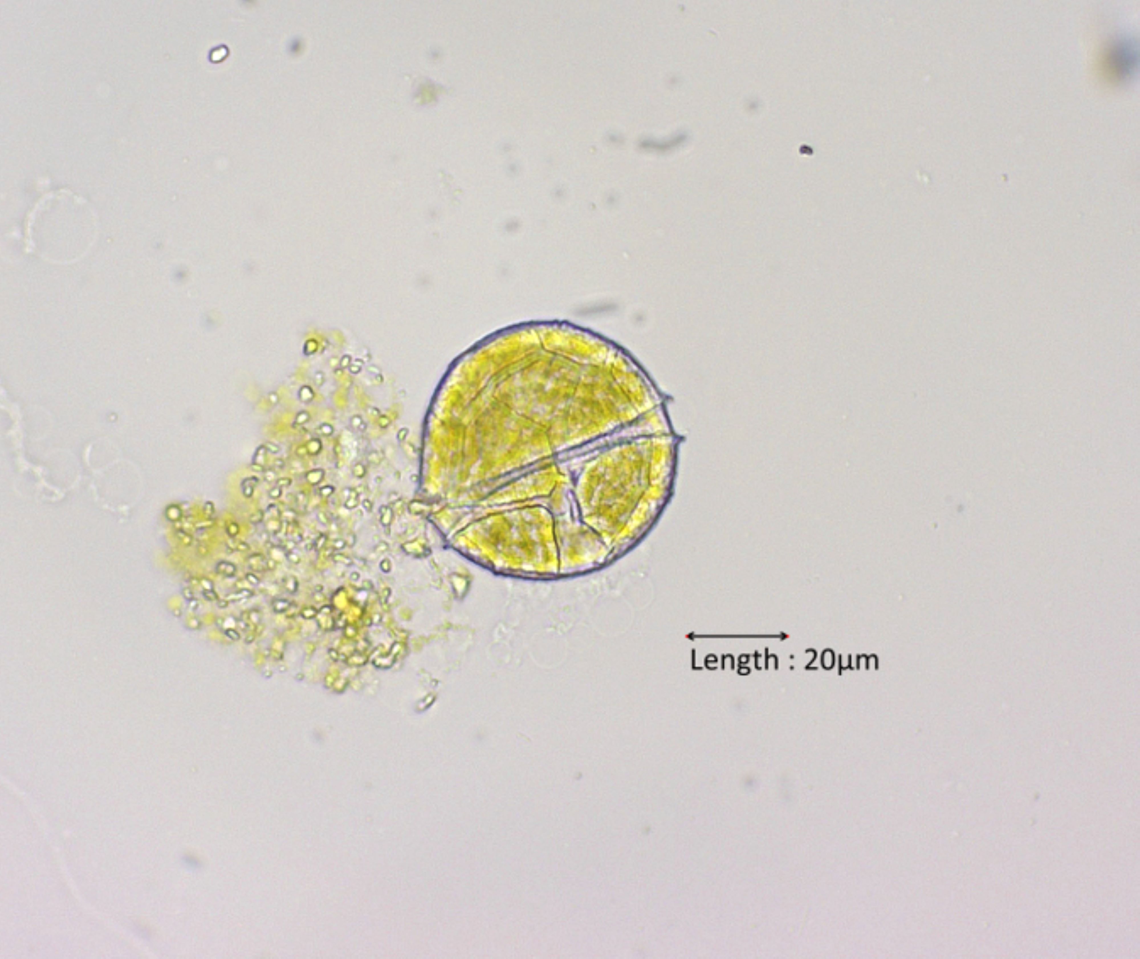 Dinophyta – A Planktonista's world