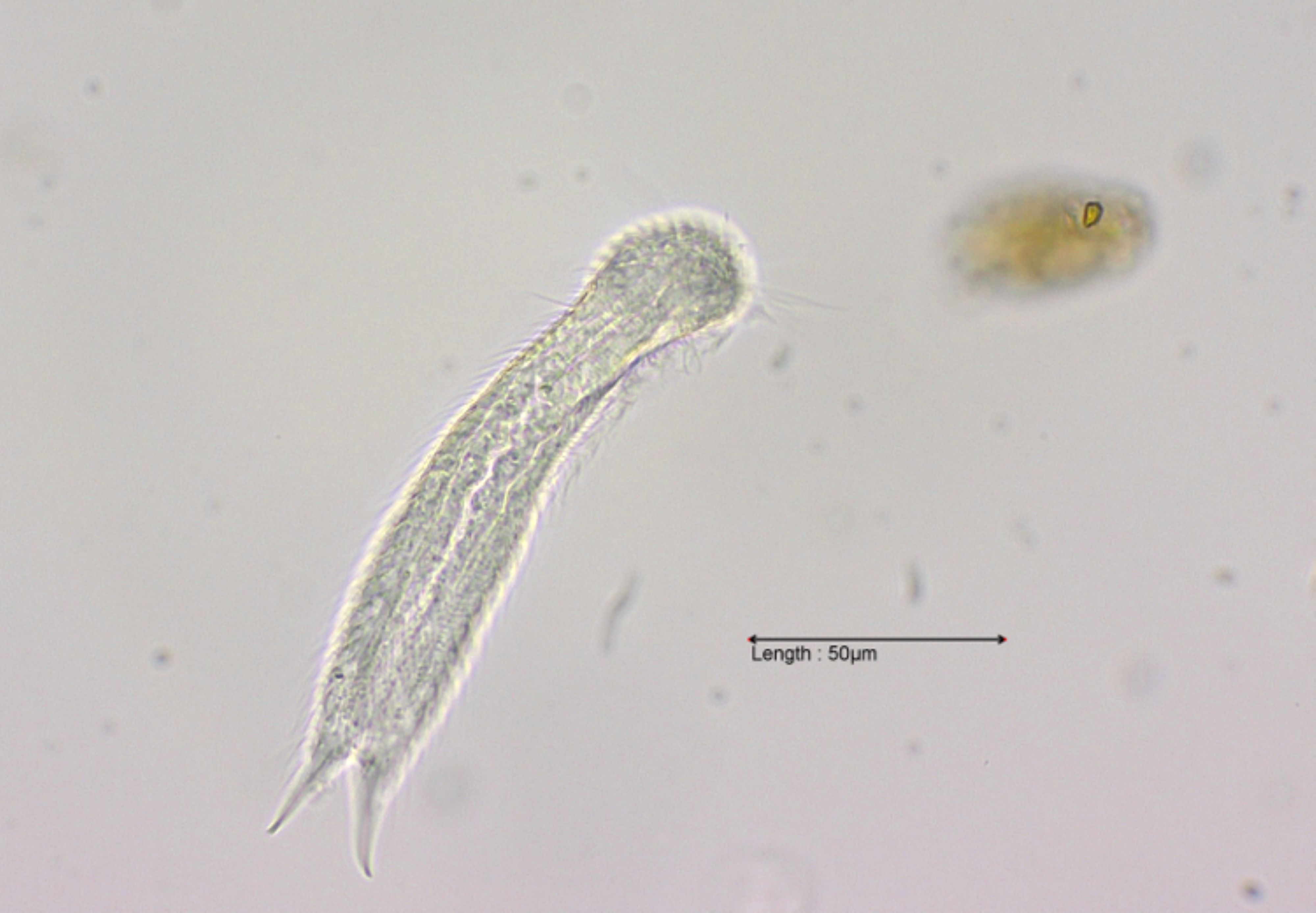 Gastrotricha – A Planktonista's world