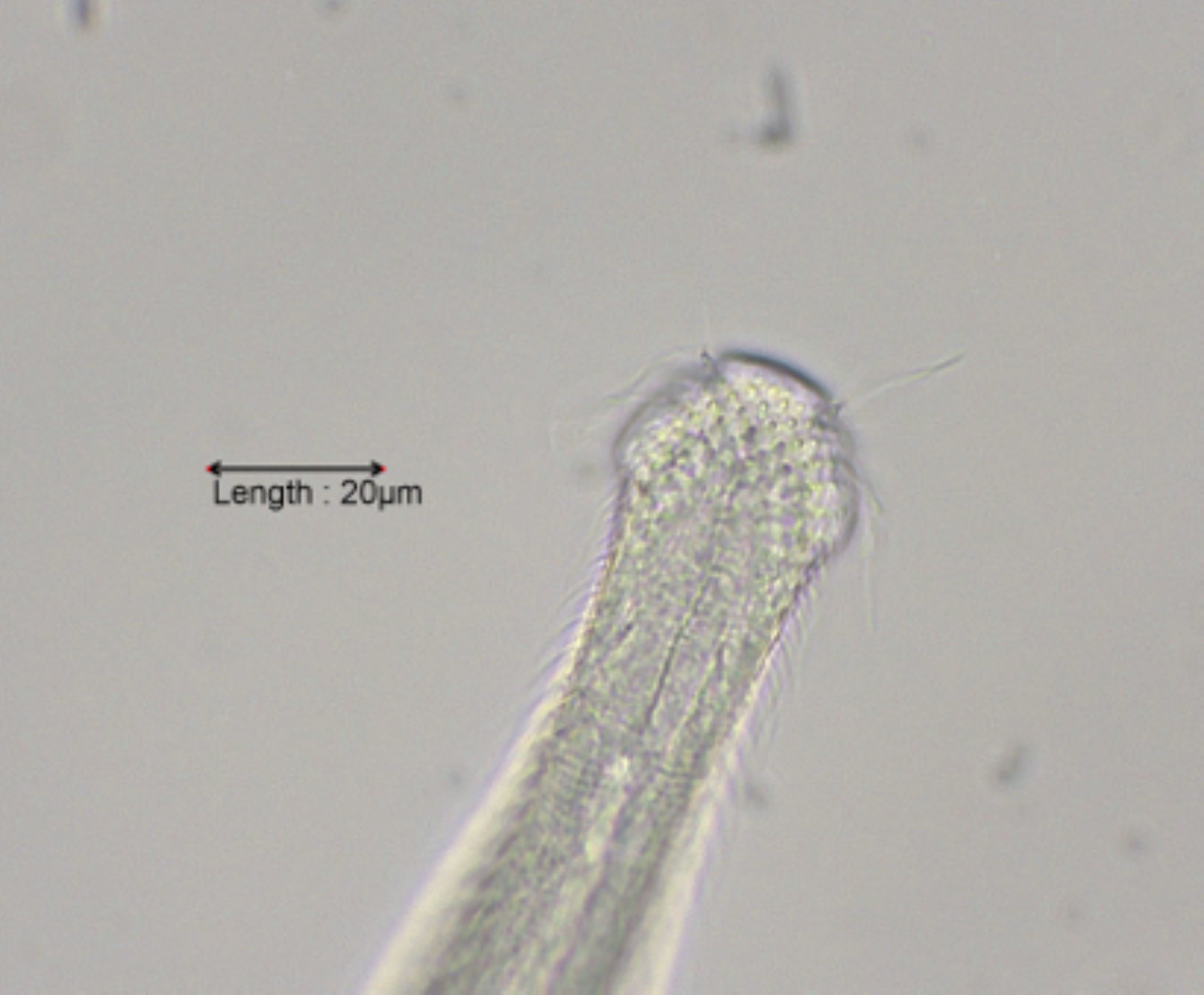 Gastrotricha – A Planktonista's world
