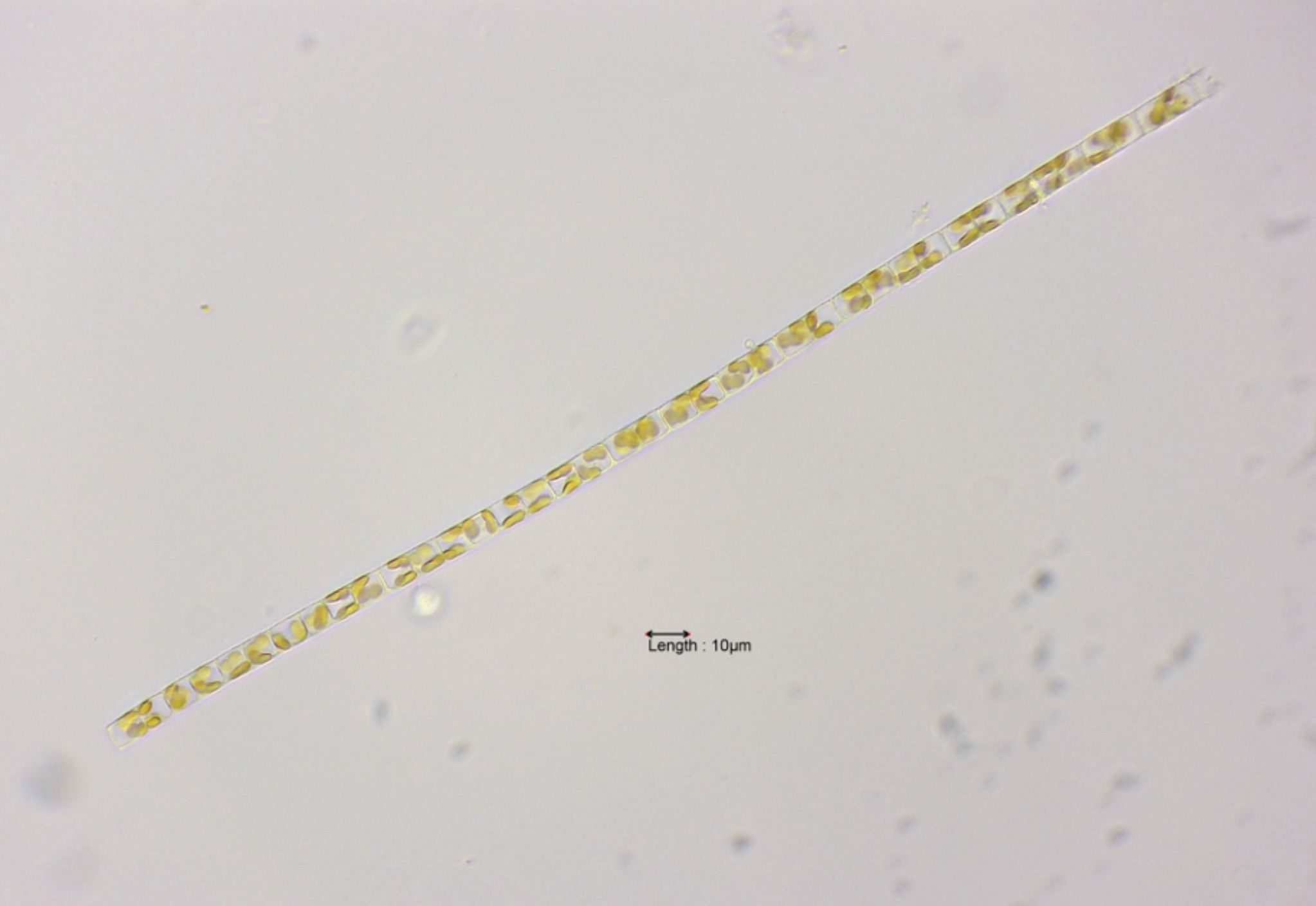 Xanthophyta – A Planktonista's world