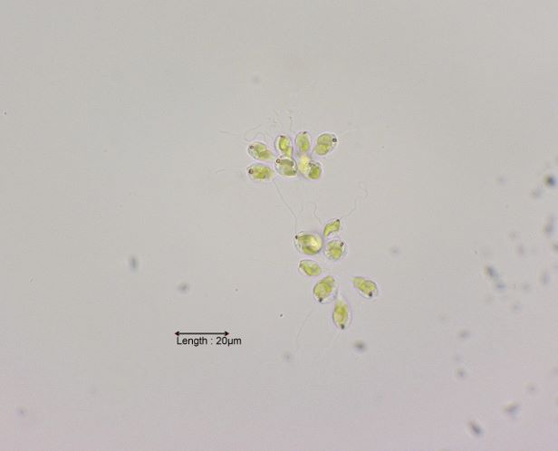 Chrysophyta – A Planktonista's world