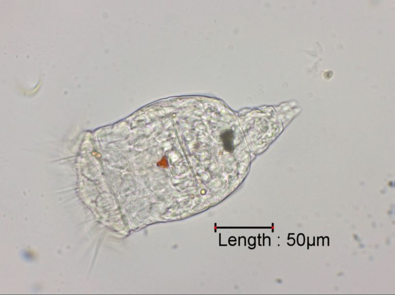 Rotifera – A Planktonista's world