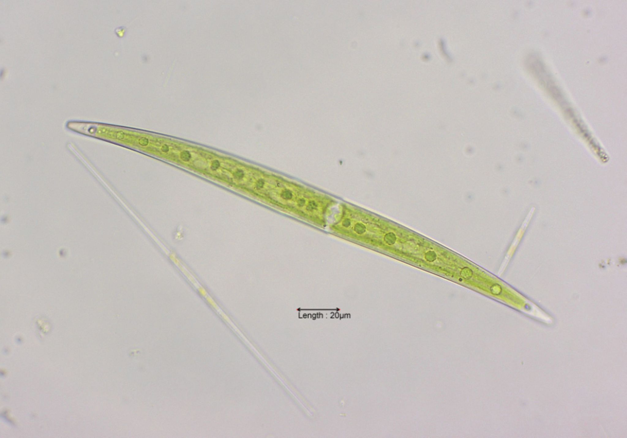 Desmids and Zygnematales – A Planktonista's world